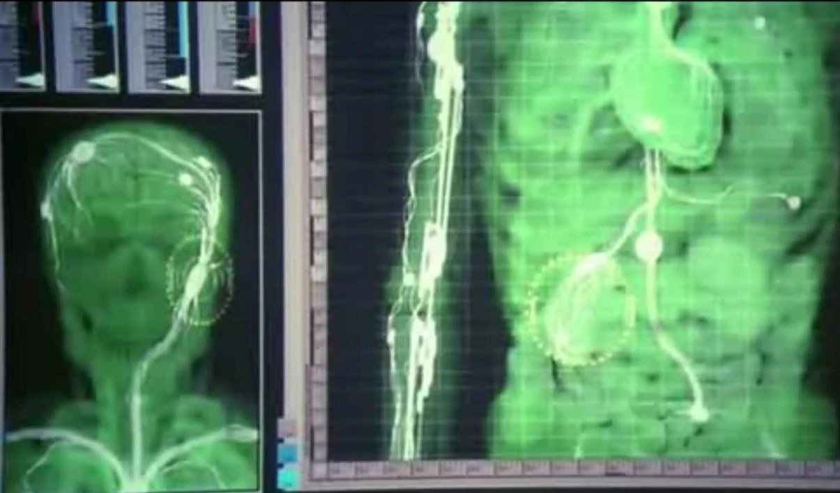 Assimilation - The Borg Collective, Star Trek Wiki